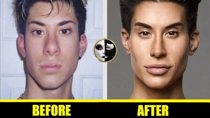 Botched Justin Plastic Surgery, Human Ken Doll Justin Jedlica Before ...