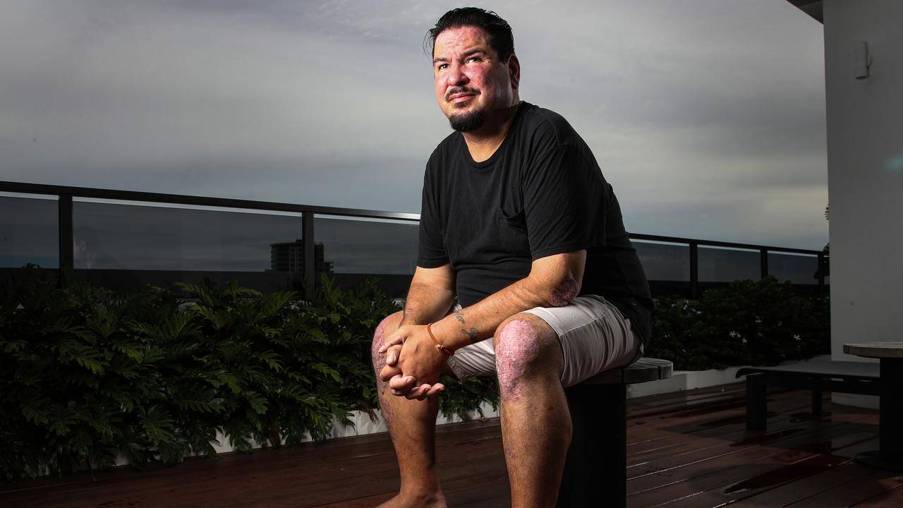 Carl Webb Death News, Carl Webb Disease, How Did Carl Webb Die? Carl ...